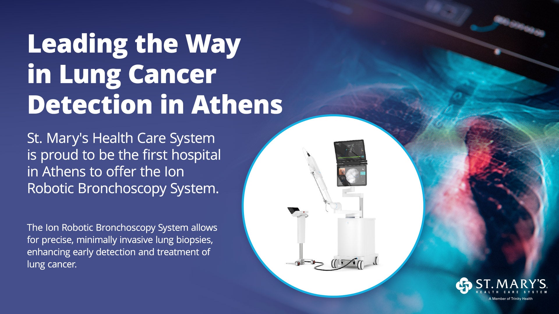 ION Bronchoscopy | Trinity Health System